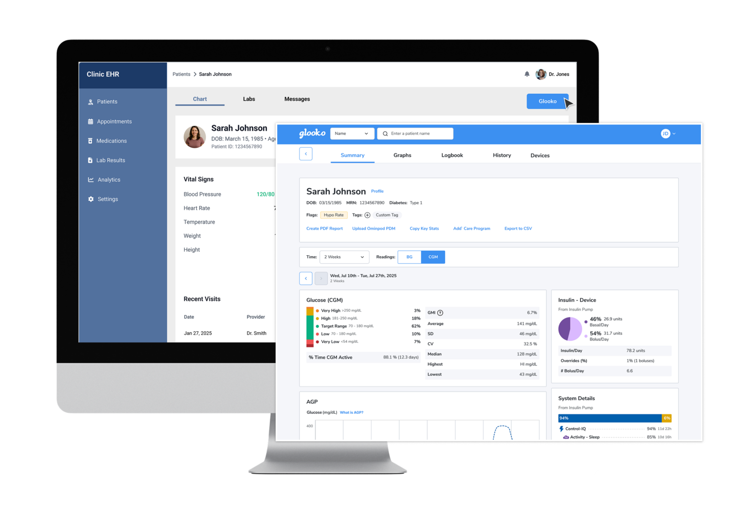 Diabetes Management for Healthcare Providers | Glooko