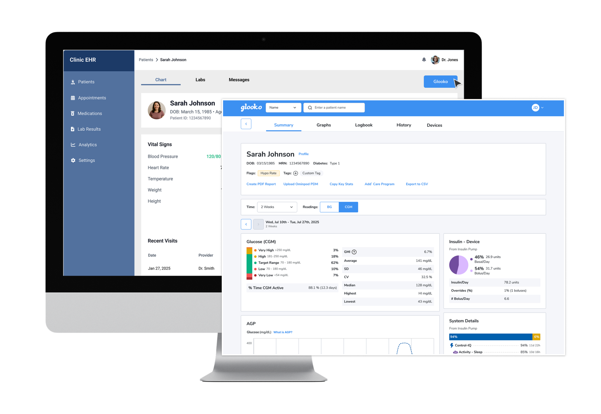 Diabetes Management for Healthcare Providers | Glooko